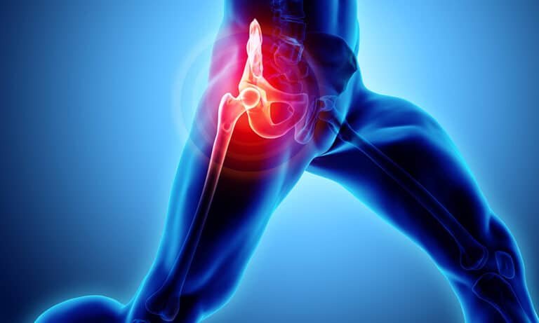 Radiculopathy Treatment Miami | Dr. Evan Trapana