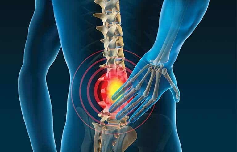 The 3 Phases of Back Injury Recovery | Florida Spine Center